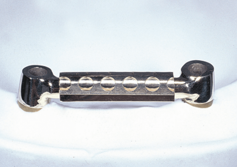 Hader Preci-Bar (Dolder) Channel | Prestige Dental