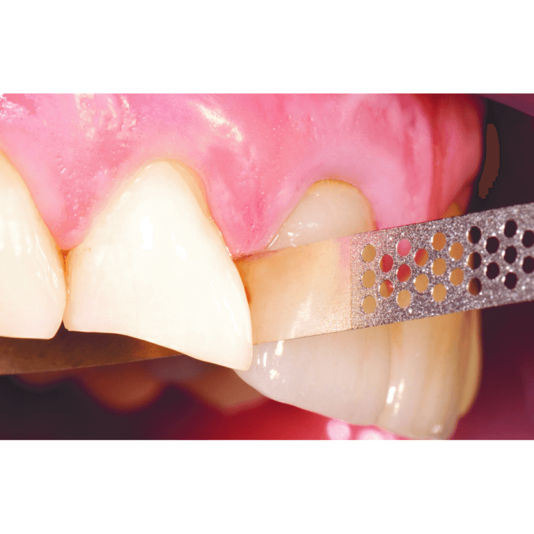 NTI Single Sided Perforated Diamond Strips | Prestige Dental