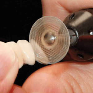 NTI 400 Superflex Diamond Disc | Prestige Dental