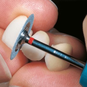 NTI 355 Superflex Diamond Disc | Prestige Dental