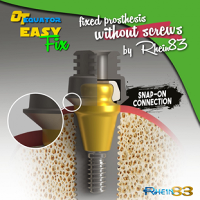 EASYFix expertise all the way from Budapest | Prestige Dental